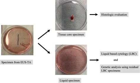 Liquid Based Cytology