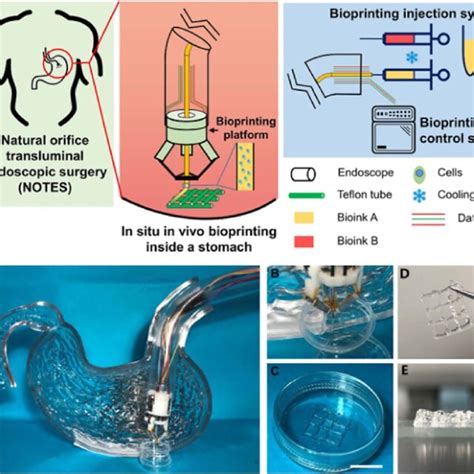 A Schematic Illustration Of Bioprinting Process Using Prp Containing