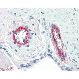 F Factor VIII Antibody