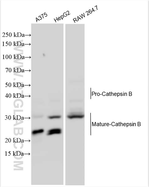 Cathepsin B Antibody 31399 1 Ap Proteintech