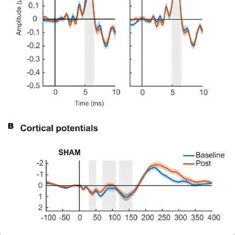A Grand Averaged Abr Waveforms Elicited By Auditory Click Stimulus