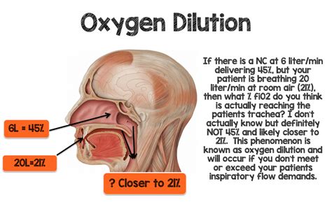 High Flow Nasal Cannula Hfnc Part 1 How It Works Rebel Em Emergency Medicine Blog