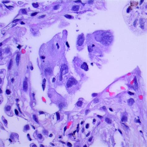 Histopathelogical Instance Segmentation Dataset And Pre Trained Model