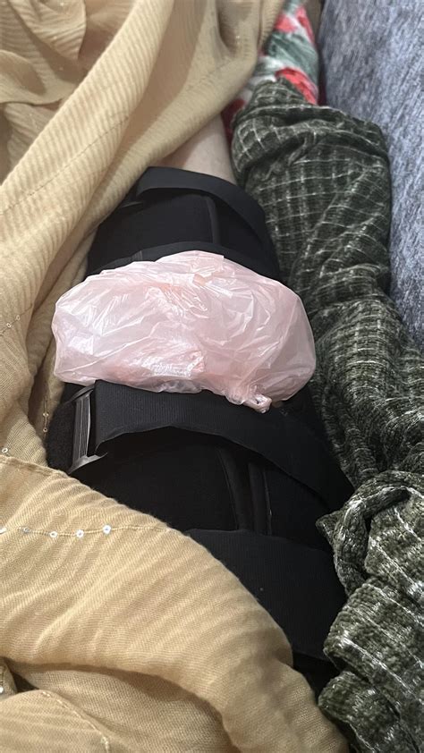 Dislocated My Kneecap… R Pics