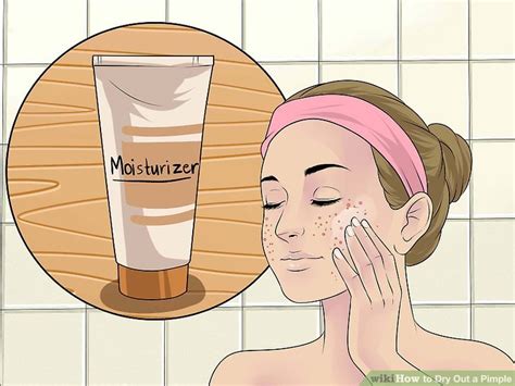 Ways To Dry Out A Pimple WikiHow