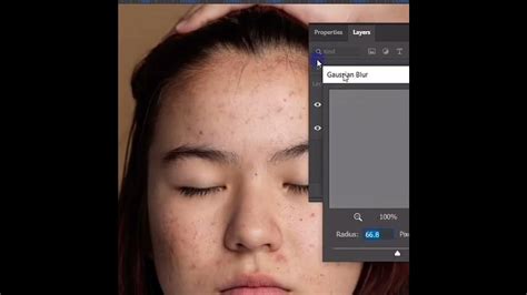 Remove Face Acnes Easily In Photoshop Photshop Graphicdesign Sivilceizleri Adobephotoshop