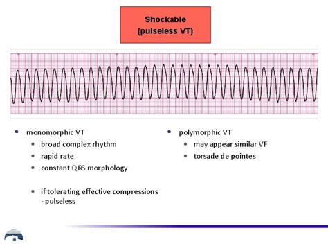 Als Algorithm Learning Outcomes This Lecture Should Enable