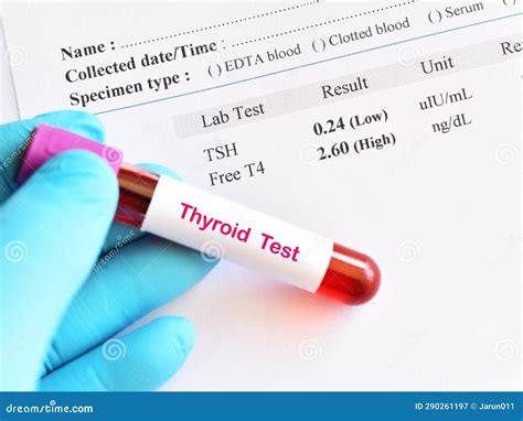 Abnormal Thyroid Hormone Result Stock Image Image Of Care Tube 290261197 Abnormal Thyroid Hormone Result Stock Image Image Of Care Tube 290261197