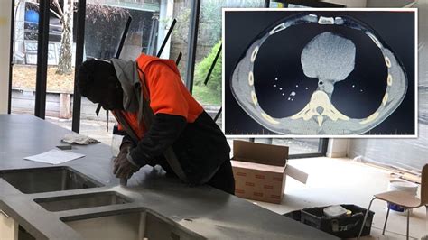 Monash Finds ‘enormous Increase In Deadly Lung Disease Silicosis Nt News