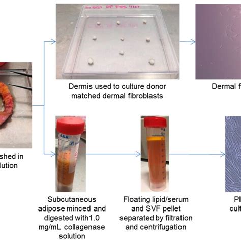 Optimised Isolation Of Ir Svf And Df From Previously Irradiated Human