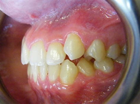 Philosophies Smiles Orthodontic Practice