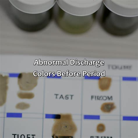 Lotion Like Discharge Before Period At William Noland Blog