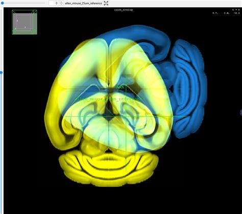 export coordinates from qupath to brainglobe usage and issues image