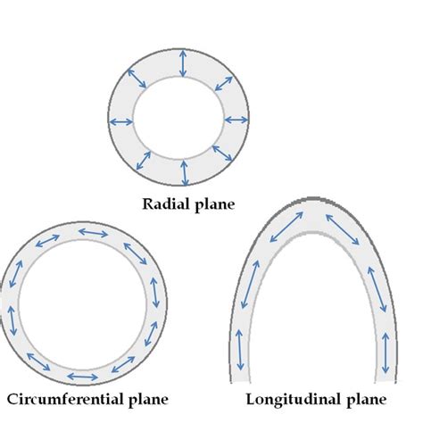 The 17 Left Ventricular Myocardial Segments Related To Coronary