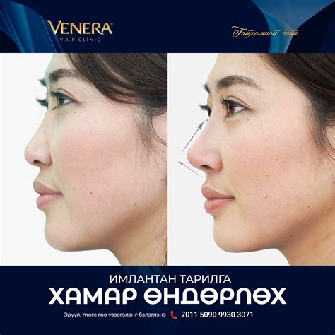 Venera ⏰ХЯМДРАЛ ДУУСАХАД 3 ХОНОГ ҮЛДЛЭЭ🤫 Өөртөө 10 хан минут зарцуулаад ҮР ДҮНгээ шууд
