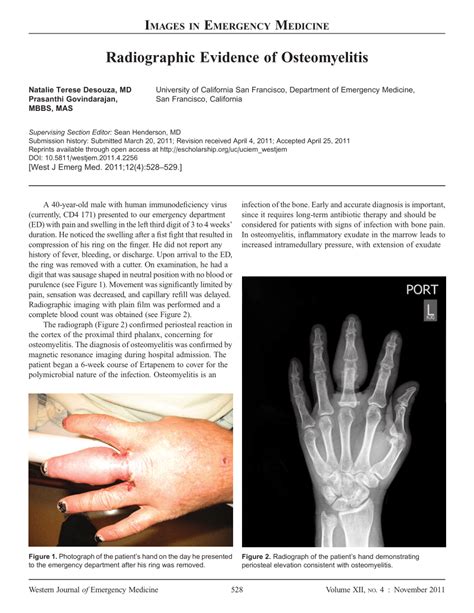 Pdf Radiographic Evidence Of Osteomyelitis