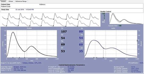 3 Sample Pulse Wave Analysis Pwa Recording Of The Radial Artery