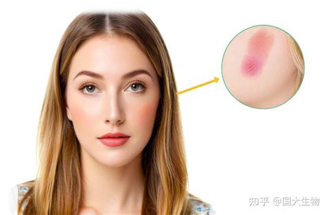 皮肤屏障受损，如何有效修复？ 知乎