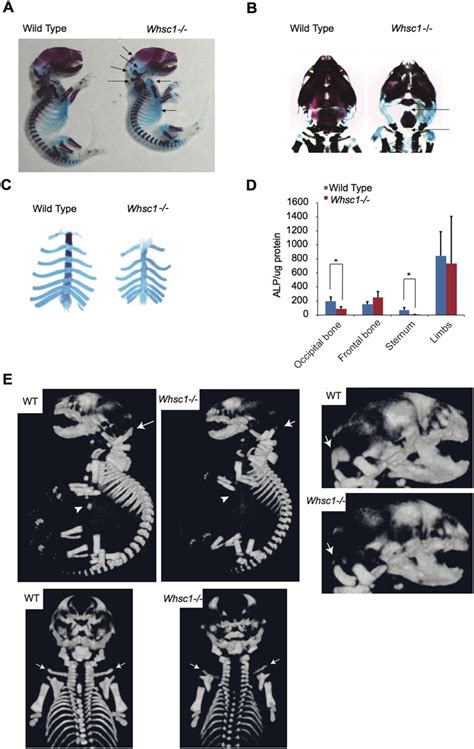 Ac Calcified Tissues From Wild Type And Whsc1−− Embryos Were Download Scientific Diagram