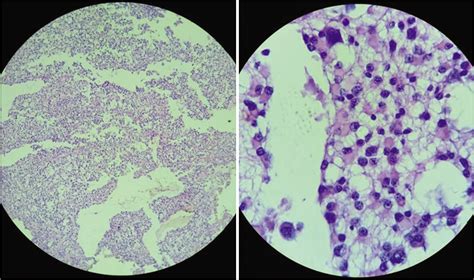 Surgical Neurology International
