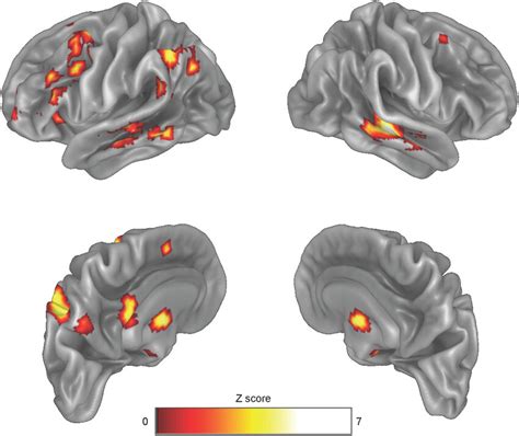 Whole Brain Analysis Map Map Represents Regions Of Significant Download Scientific Diagram