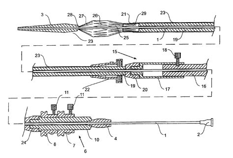Aortic Stent Patented Technology Retrieval Search Results Eureka