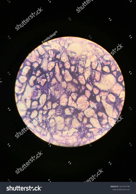 Elastic Connective Tissue Under Microscope Stock Photo Shutterstock