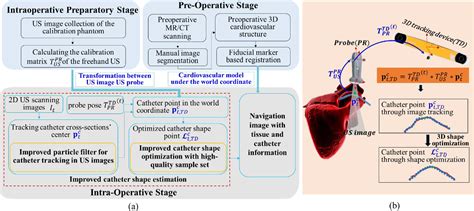 Figure 1 From Improved 3d Catheter Shape Estimation Using Ultrasound