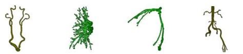 examples of segmentation results from left to right carotid mra