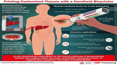 Handheld Bioprinter That Prints Personalised Tissues And Organs Technology Networks