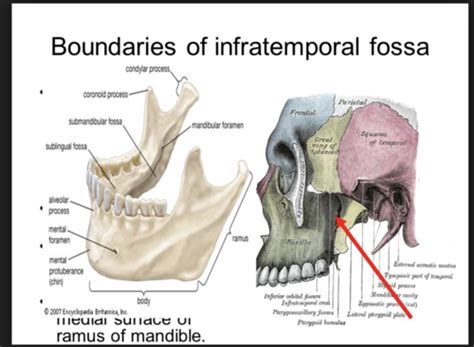 Infratemporal Surface Of Greater Wing Of Sphenoid