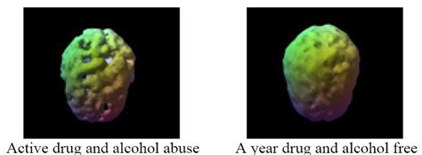 Understanding Brain Imaging Neuroanthropology