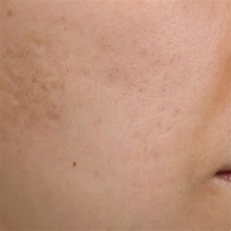 Potenza Thérapie Clinic