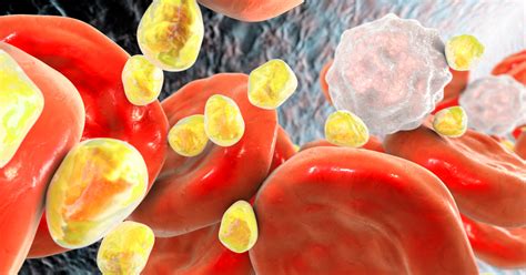 Colesterol Total E Frações Valores Normais E Interpretação
