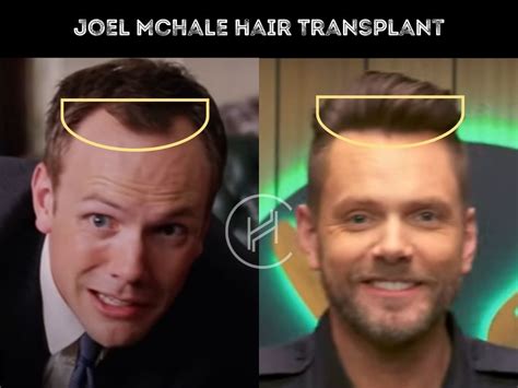 Joel Mchale Hair