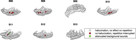 Parallel And Distributed Encoding Of Speech Across Human Auditory