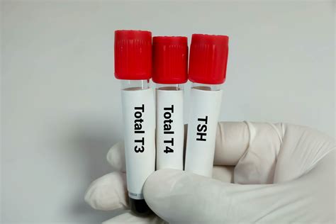 Triiodothyronine Test T3 Test Purpose Procedure And Level