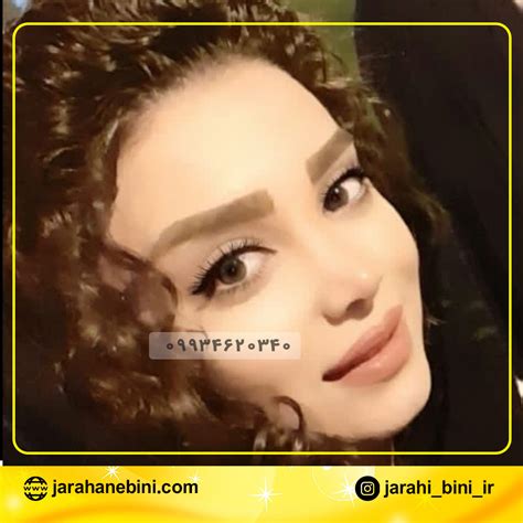 دکتر اکبر اعتمادی متخصص جراحی زیبایی