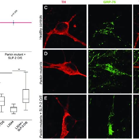 Complex I Activity And Mitochondrial Network Morphology In Ipsc Derived