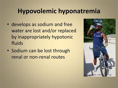 Ppt Hyponatremia Powerpoint Presentation Free Download Id 393557