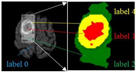 Applied Sciences Free Full Text A Multi Brain Tumor Region Segmentation Model Based On 3d U Net