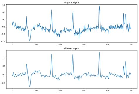 Rhythmi A Deep Learning Based Mobile Ecg Device For Heart Disease