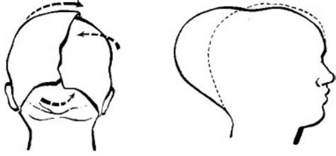 7 03 Characteristics Of The Newborn Infants Head Obstetric And