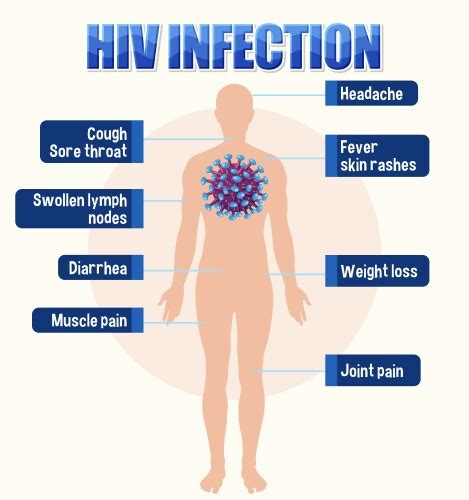 Informative Poster Of Hiv Infection Royalty Free Vector