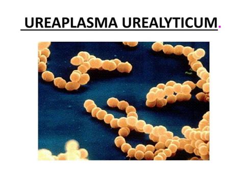 Sexually Transmitted Diseases Pptx Sexually Transmitted Diseases Pptx