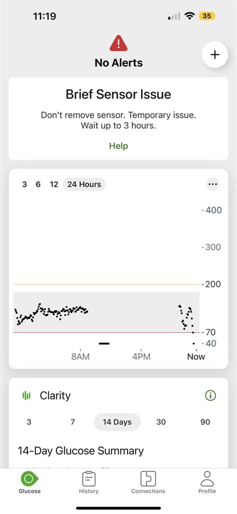 Sensor Error R Dexcom