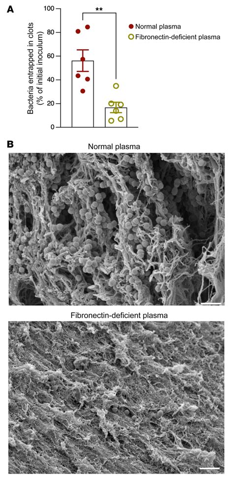 Fibronectin Is Important For Gbs Entrapment In Fibrin Clots A And B