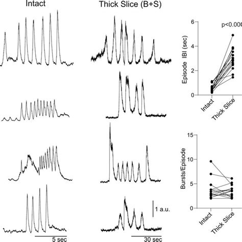 Comparison Of Episodic Output In Intact And Reduced Networks Example