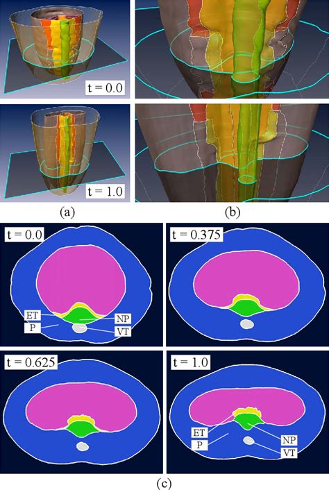 Figure 1 From Visualizing Morphogenesis And Growth By Temporal Interpolation Of Surface Based 3d