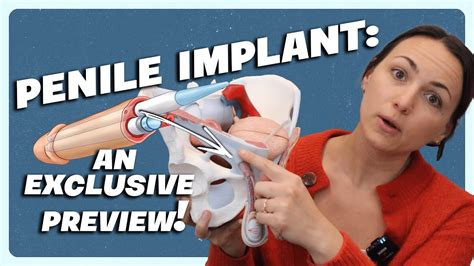Penile Implant For Erectile Dysfunction Youtube